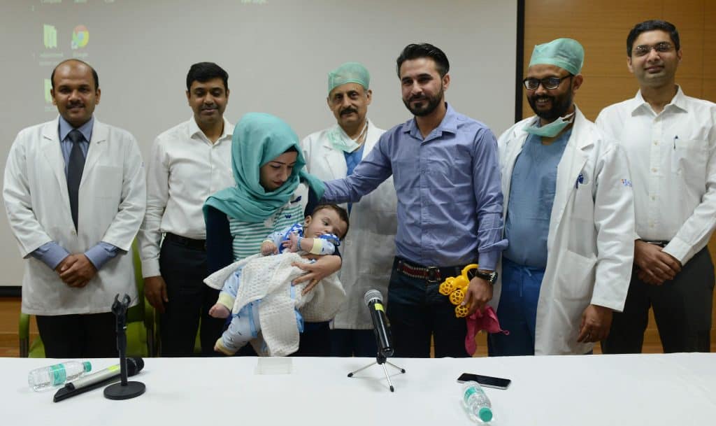 Indian doctors successfully operate on baby with eight limbs in world s ...