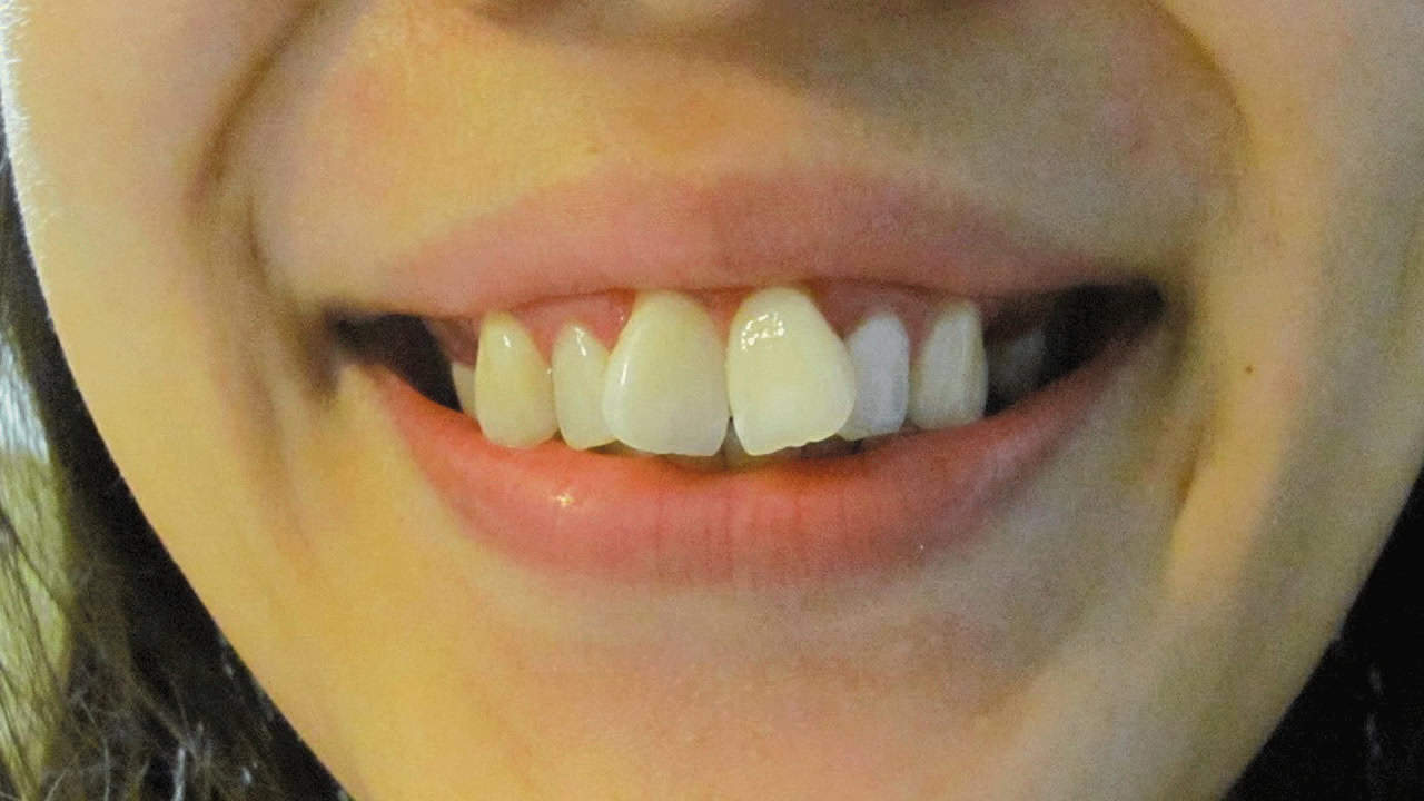 Stomach-churning video shows maggots wriggling between patient s teeth ...