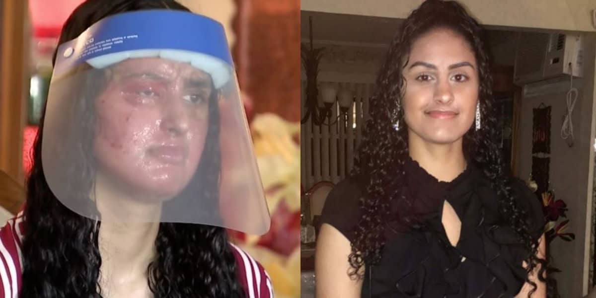 Pakistan-origin girl blinded, disfigured in New York acid attack