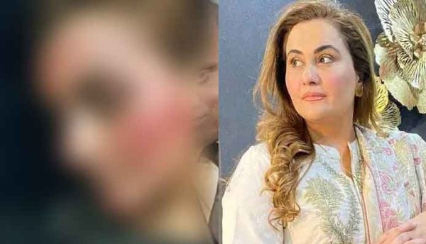 Actress Nargis assaulted by husband over money dispute