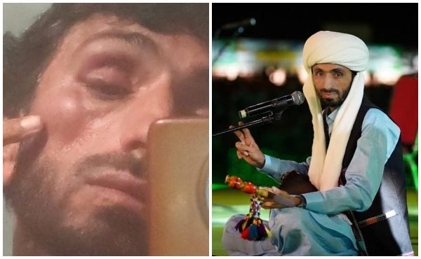 Singer Wahab Bugti assaulted by Balochistan Minister’s Son in Naseerabad